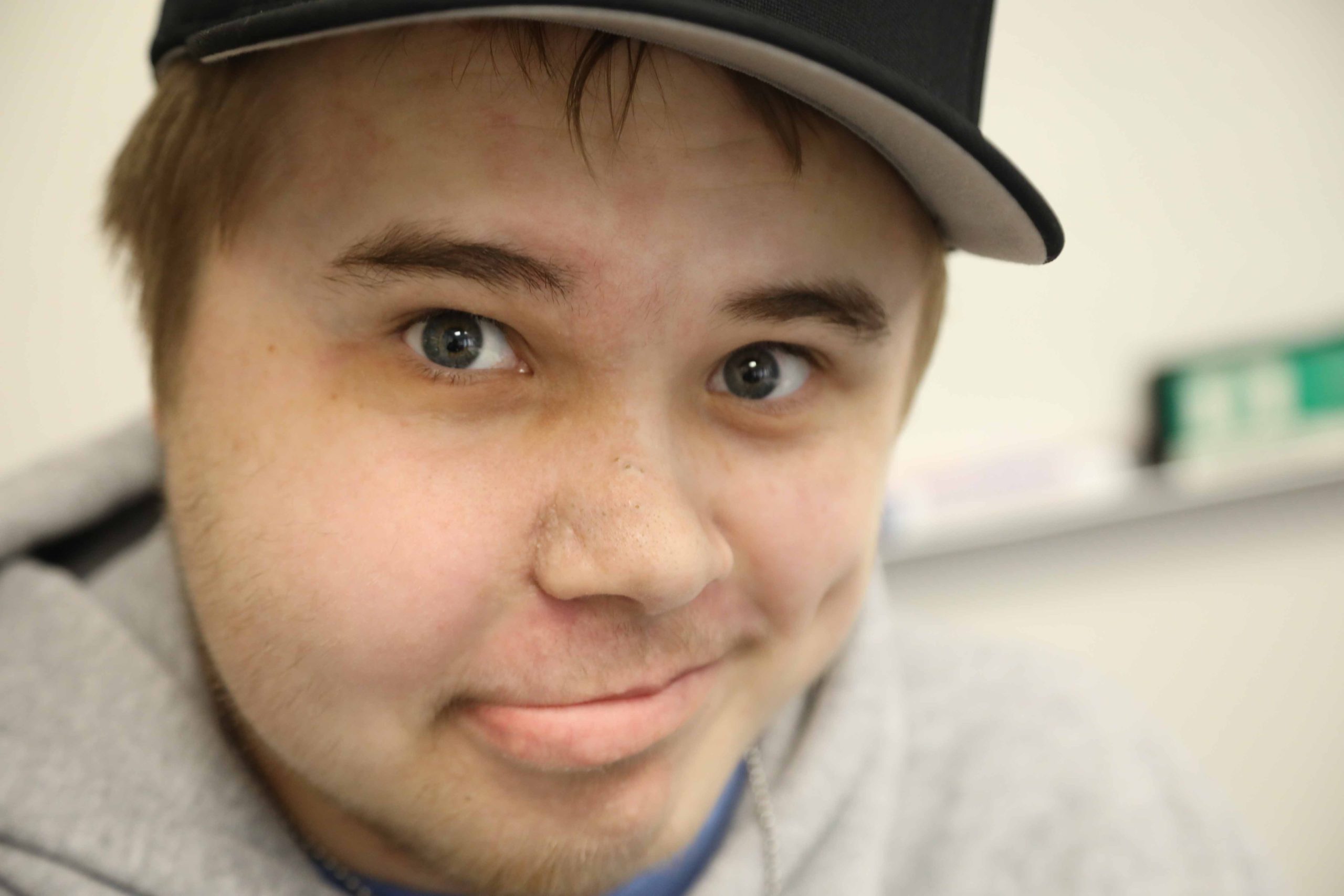 Photo Gallery | Cloves Syndrome Community